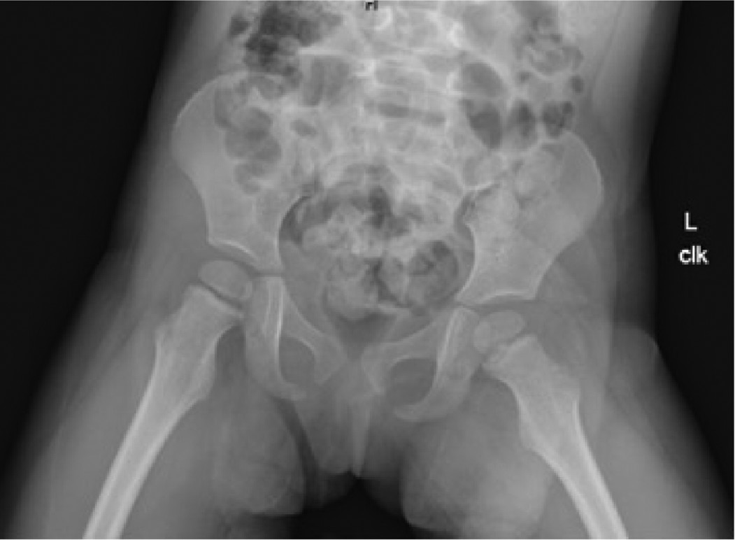 View of Pediatric Musculoskeletal Infection Roundtable: Tips and Tricks ...